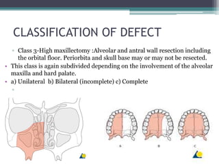 Palato maxillary reconstruction | PPTX | Ear, Nose and Throat ...