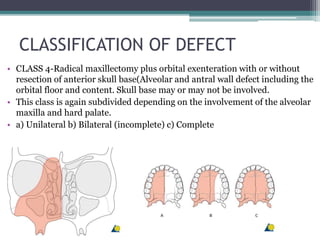 Palato maxillary reconstruction | PPTX