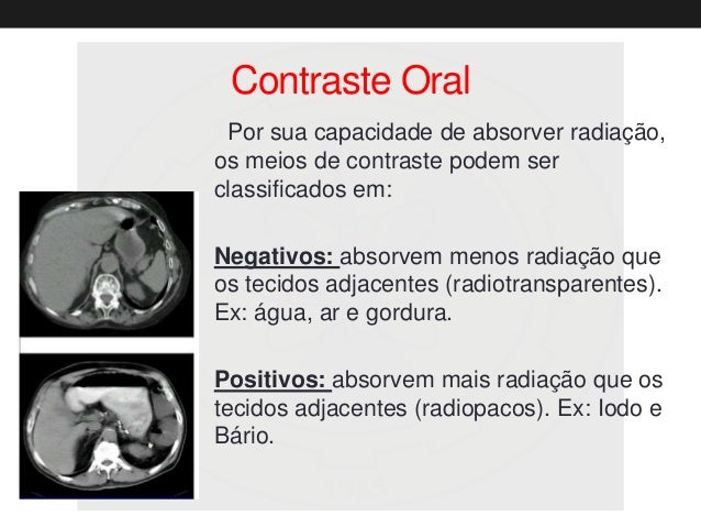 Meios de Contraste em Tomografia