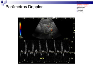 Ultrassonografia vascular: modo B e Doppler - FLAUS 2014