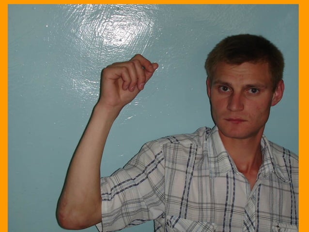 Paleta humerala-2008 Clasificare_1-2.ppt