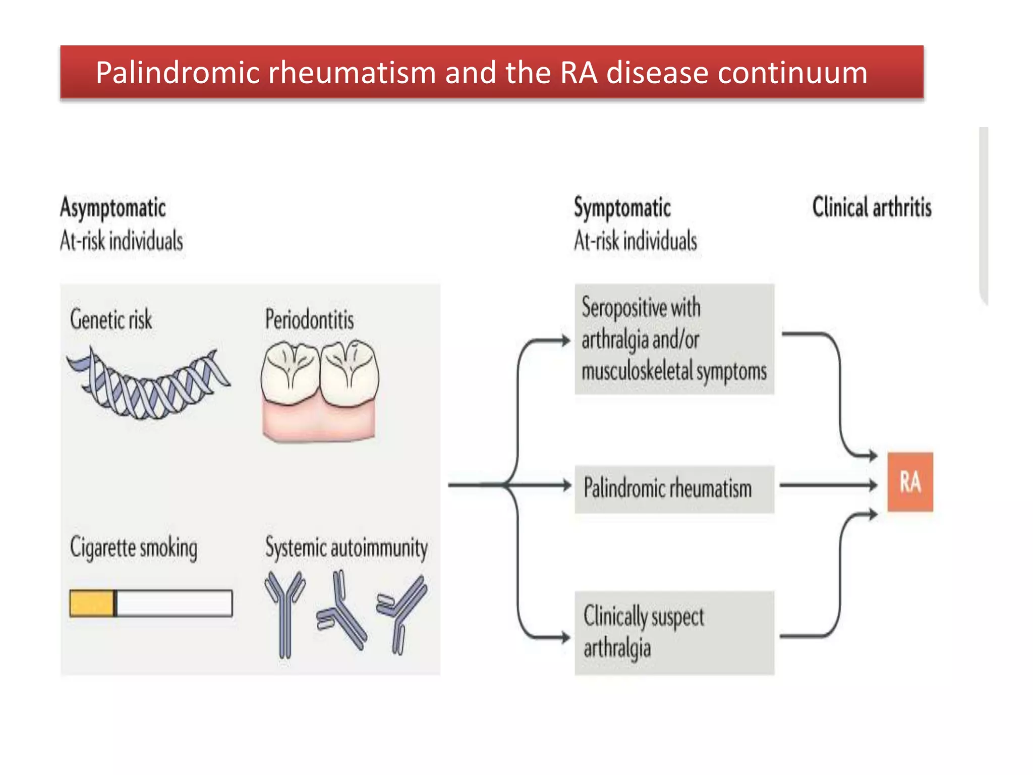 Palindromic rheumatrism.pptx