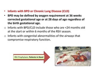 Respiratory Syncytial Virus in children | PPTX