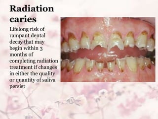 Management of oral problem in Palliative care setting | PPTX