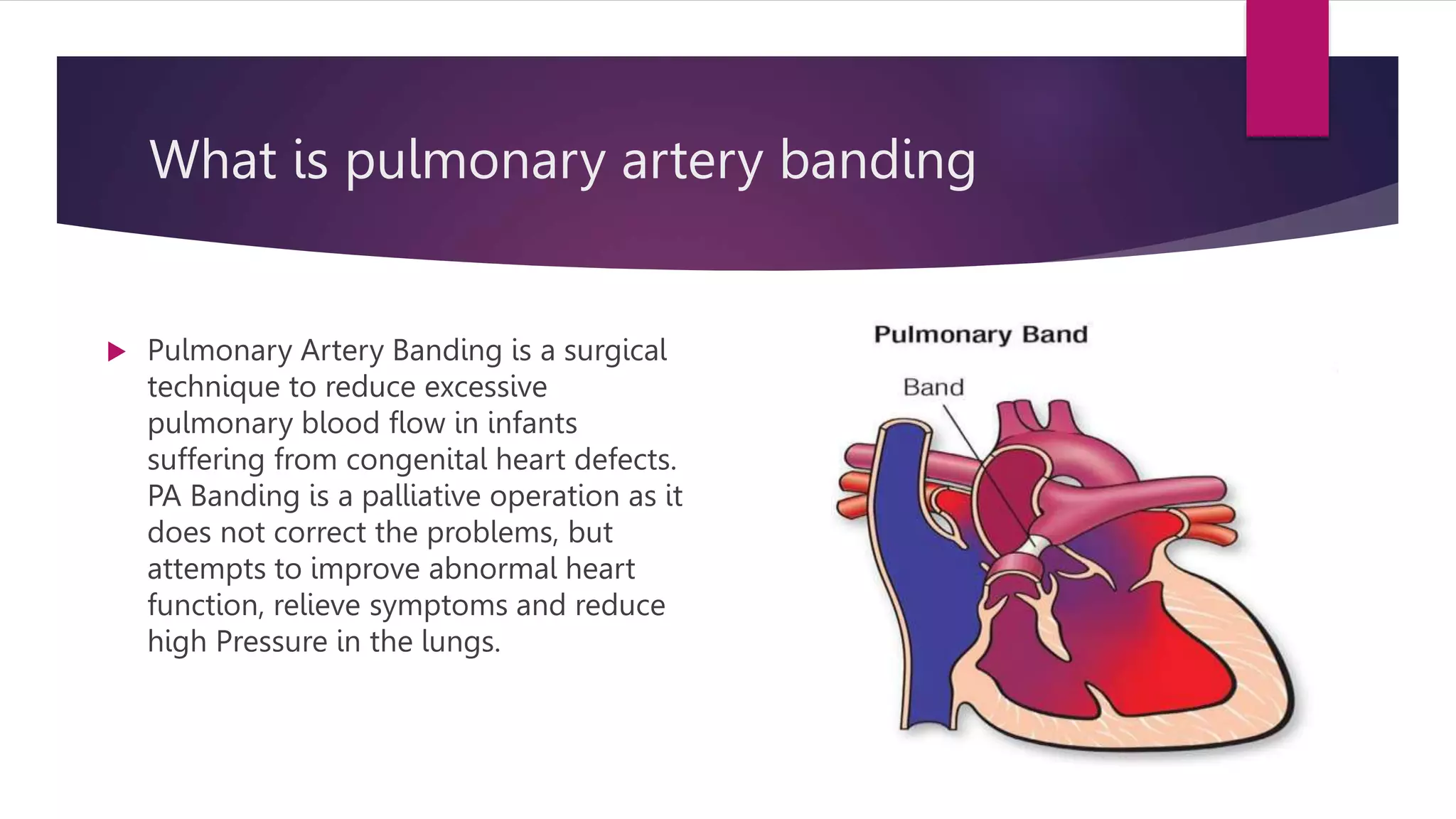 palliative cardiac surgery.pptx