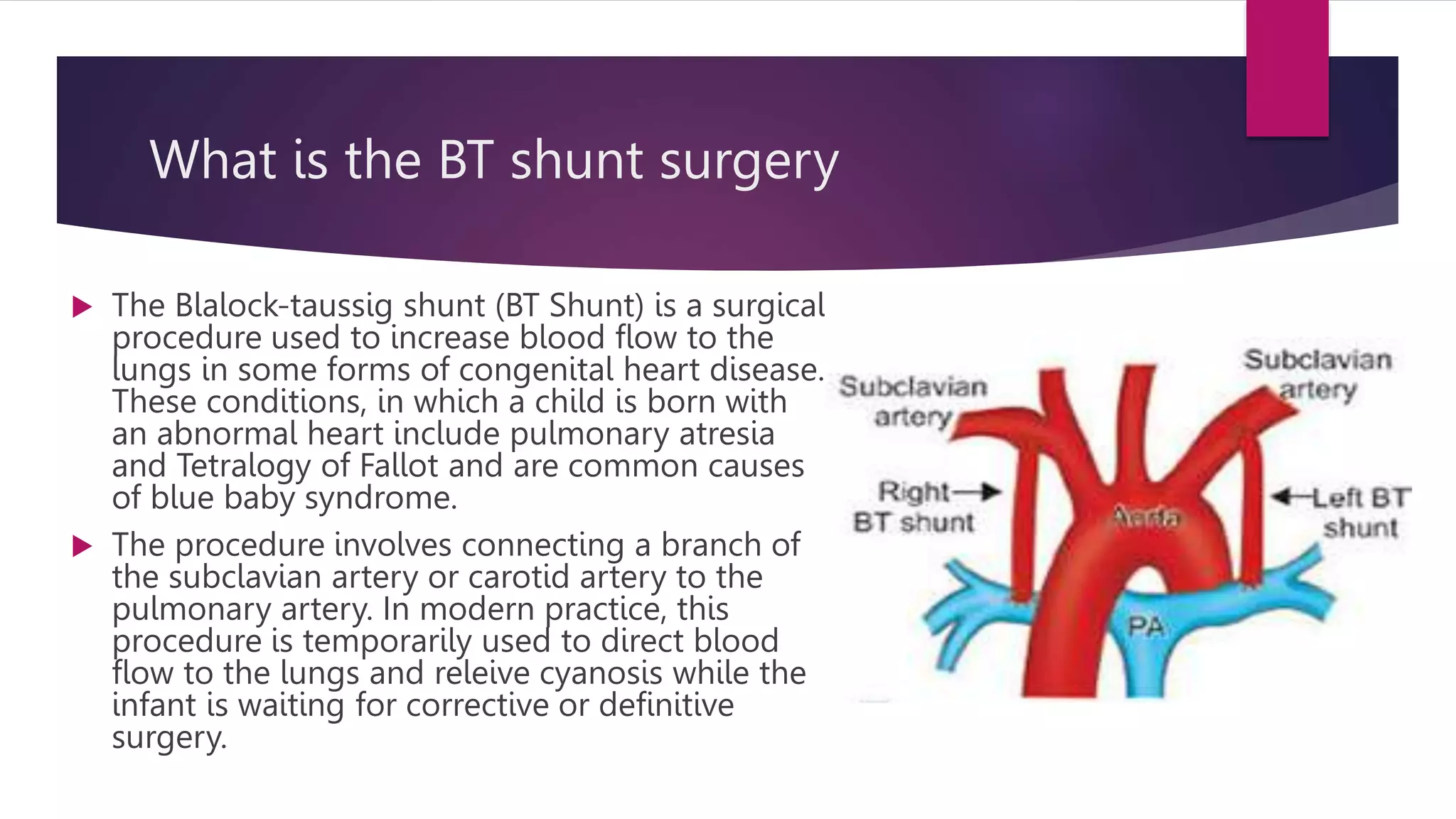 palliative cardiac surgery.pptx
