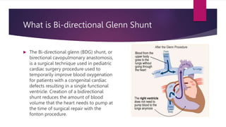 palliative cardiac surgery.pptx