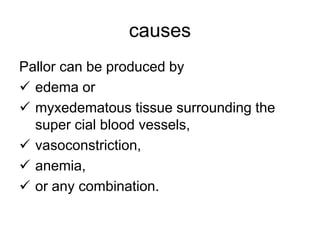 Pallor.pptx