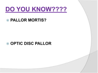 Pallor agp | PPT