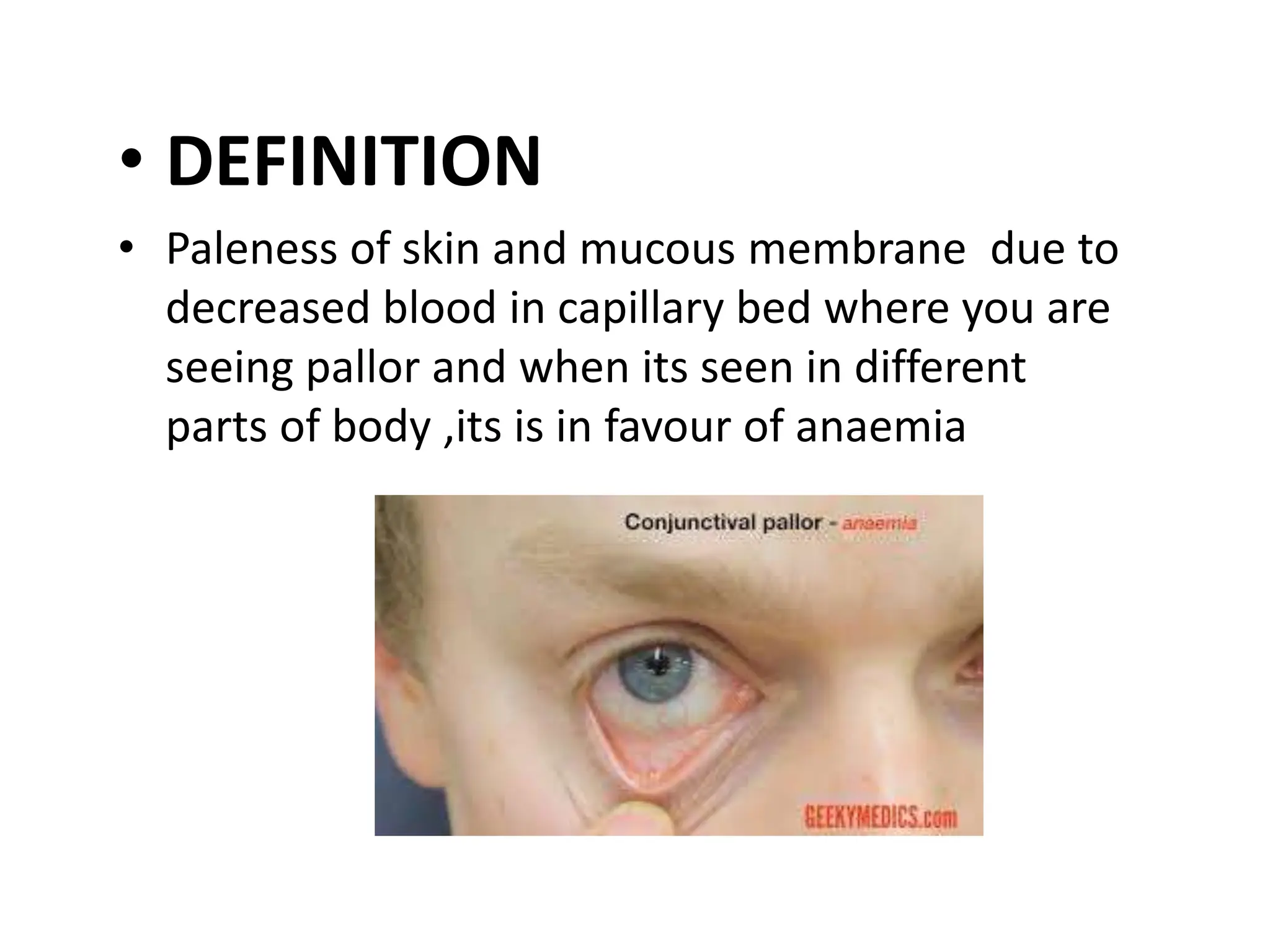 Causes and types of pallor which are clinically signufucant | PPT ...