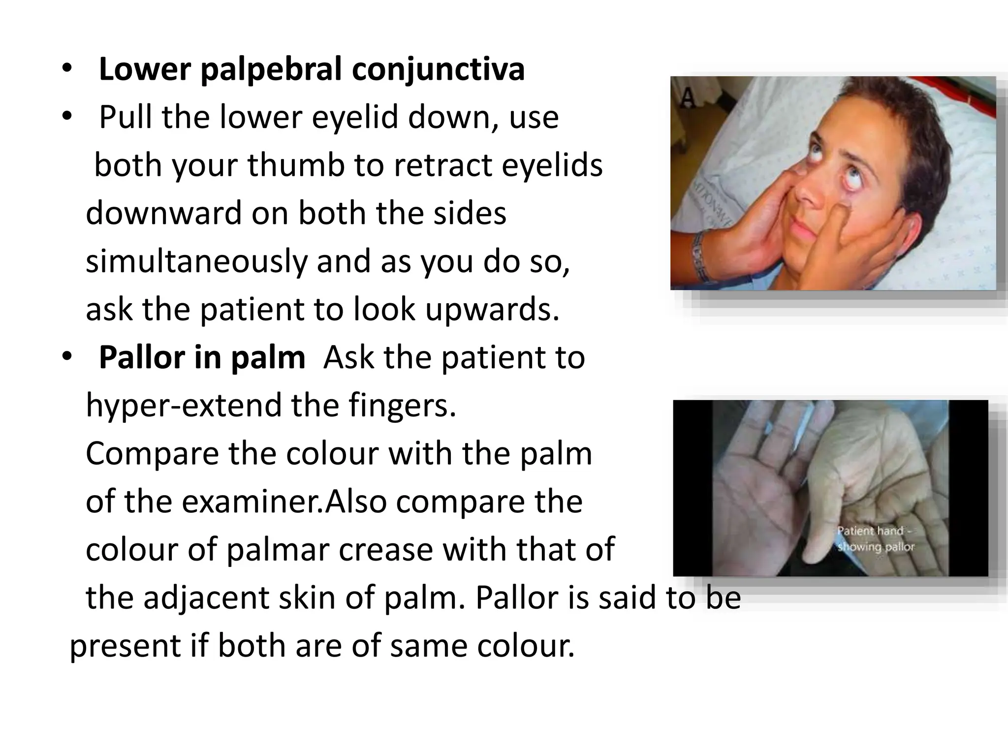 Causes and types of pallor which are clinically signufucant | PPT ...