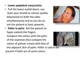 Causes and types of pallor which are clinically signufucant | PPT