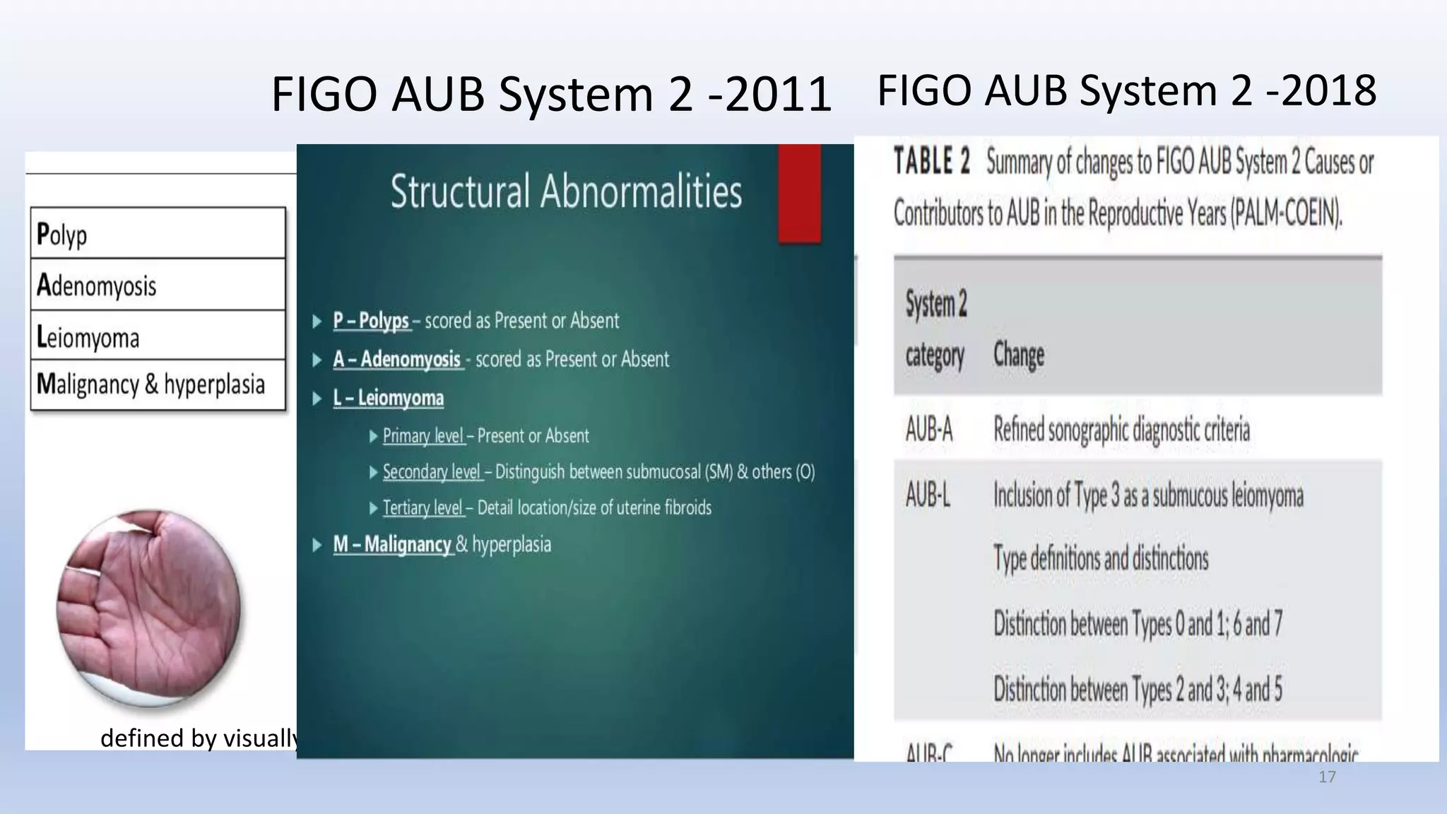 Palm coein classification its clinical significance -final | PPT