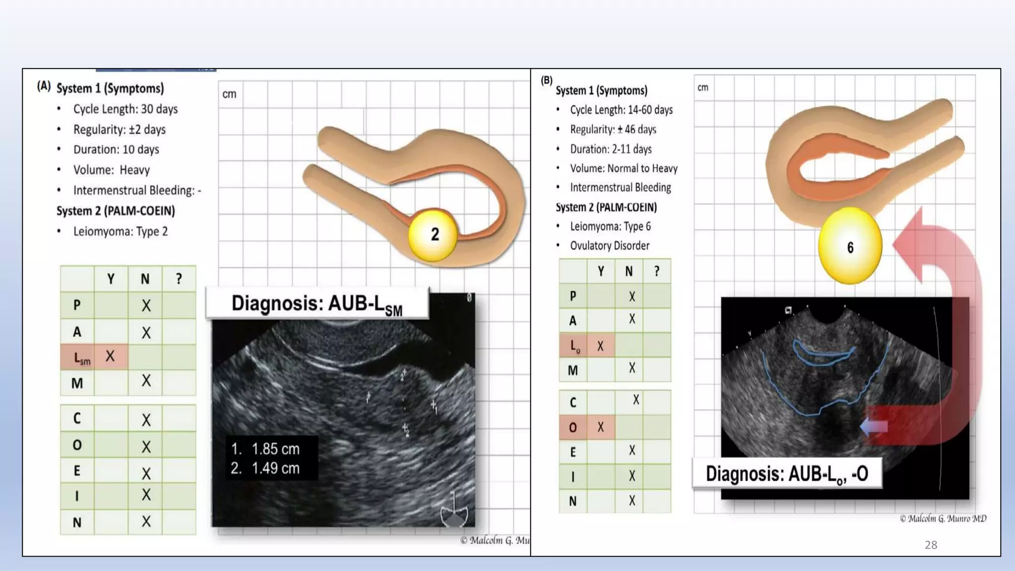 Palm coein classification its clinical significance -final | PPT