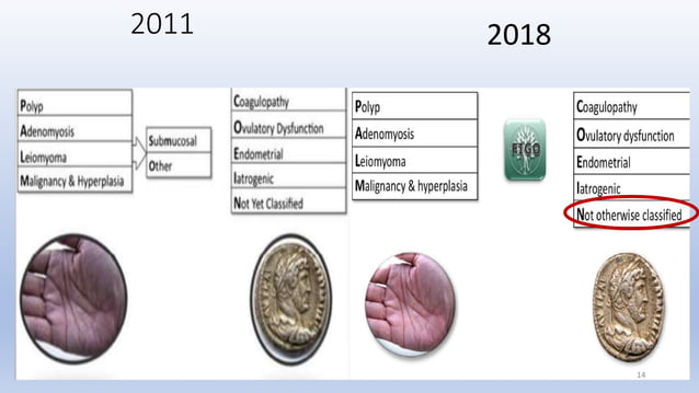 Palm coein classification its clinical significance -final | PPT