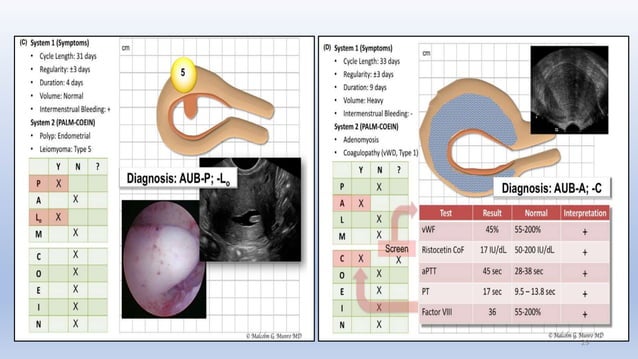 Palm coein classification its clinical significance -final | PPT