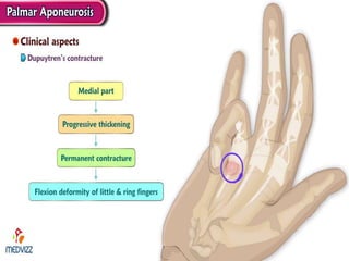 Palmar Aponeurosis by Amna Shaheen.ppt