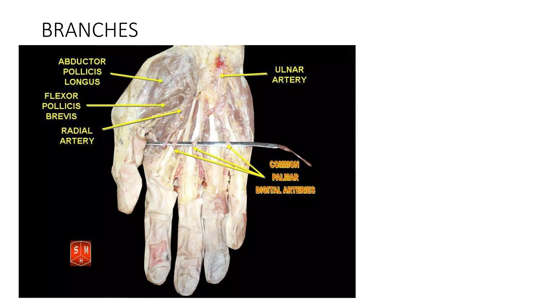 palmar arches.ppt