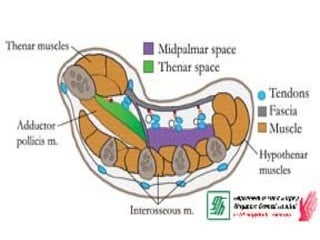 Palmar spaces | PPT