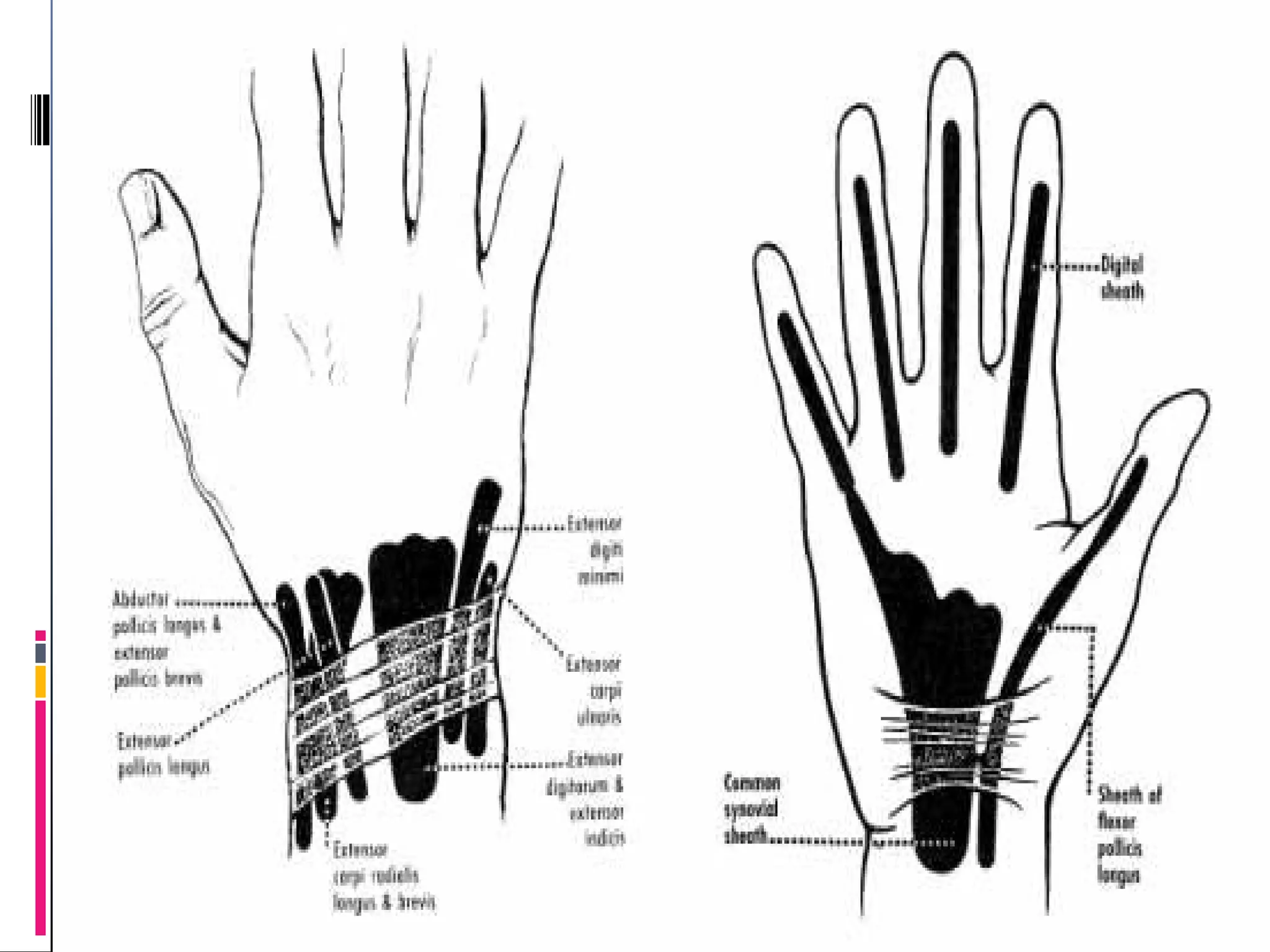 Palmar spaces - Types / contents | PPT