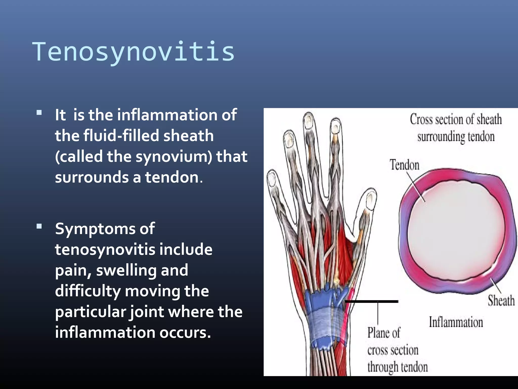 Palmar spaces - Types / contents | PPT