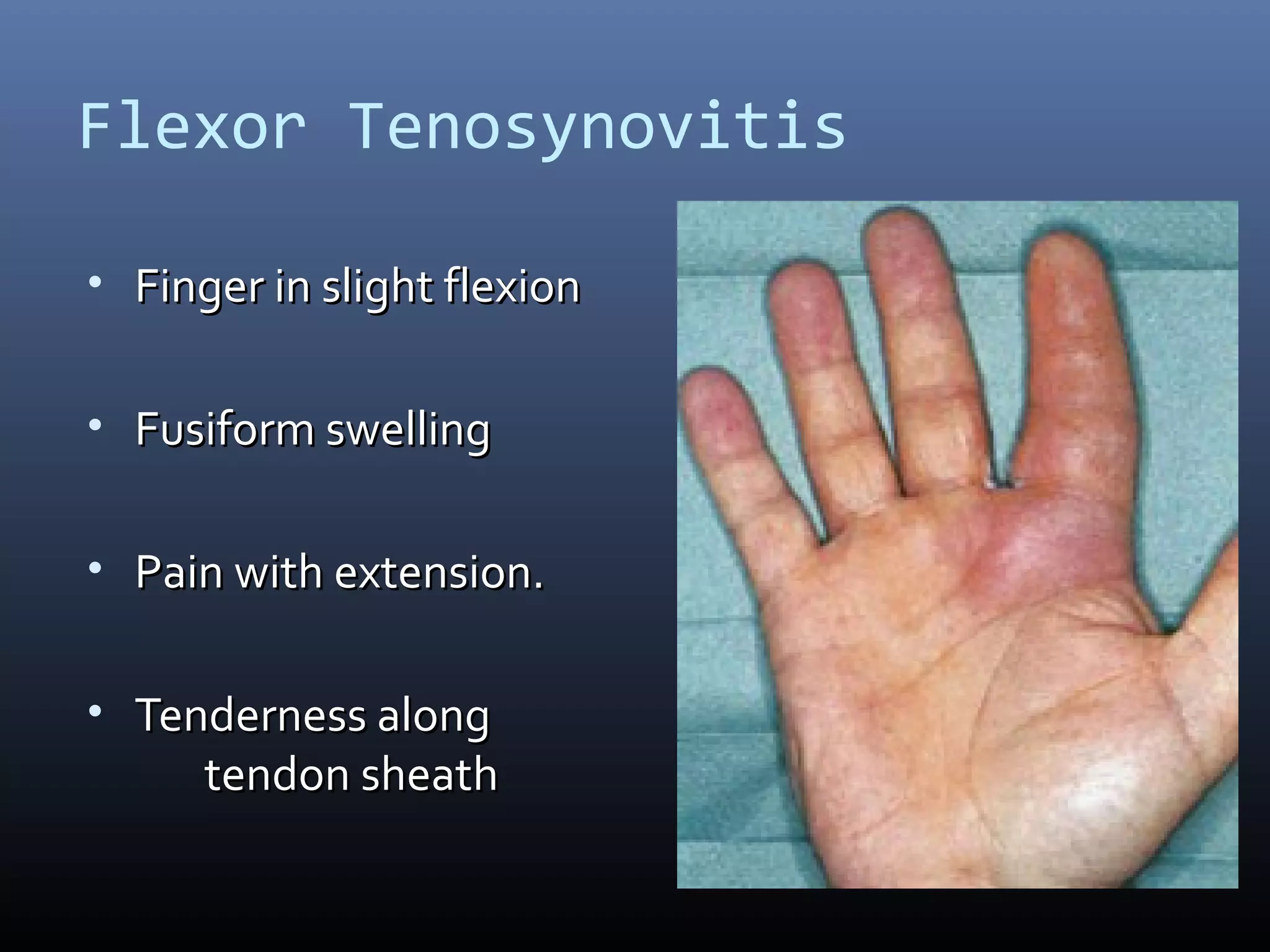 Palmar spaces - Types / contents | PPT