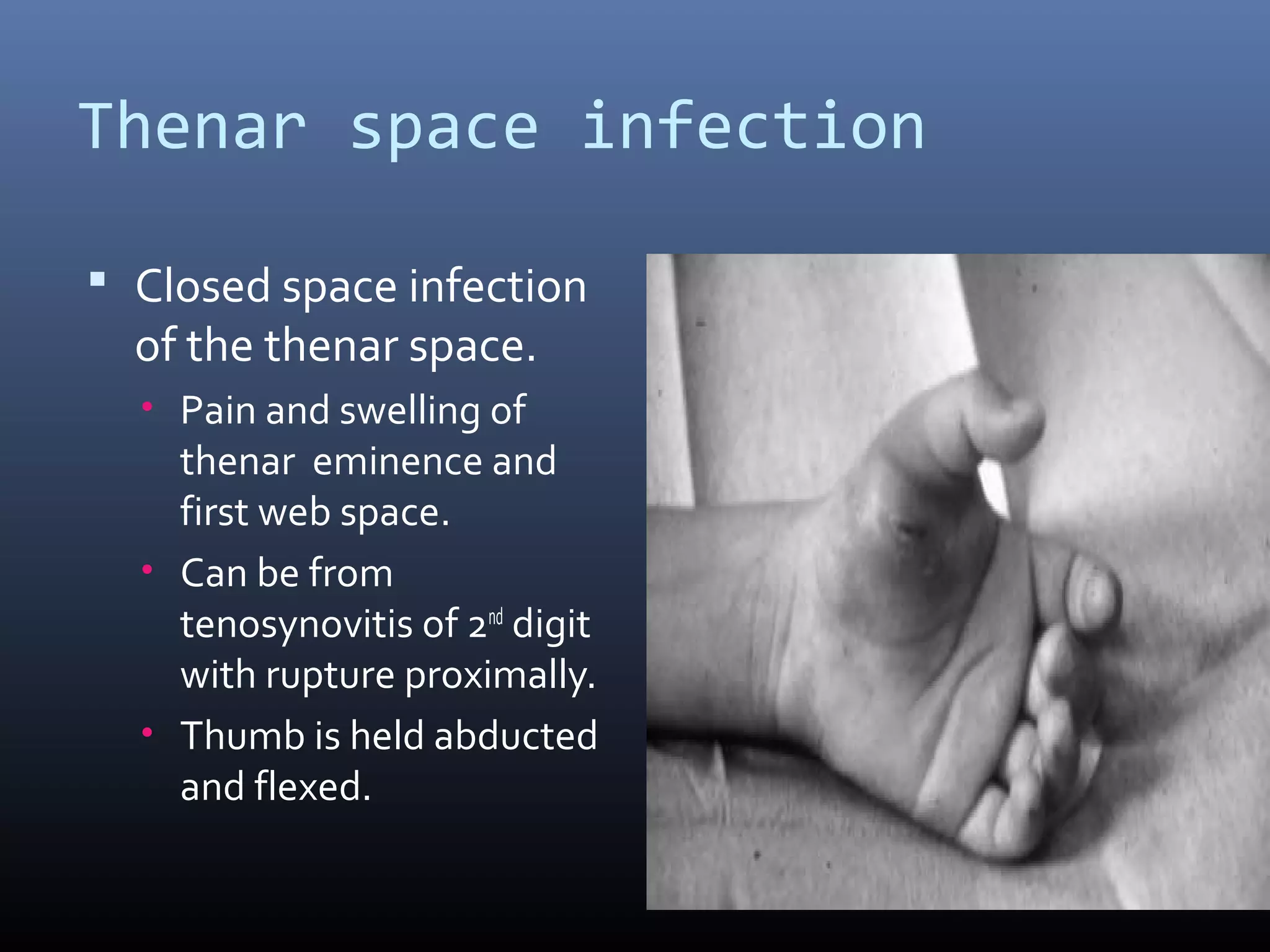 Palmar spaces - Types / contents | PPT