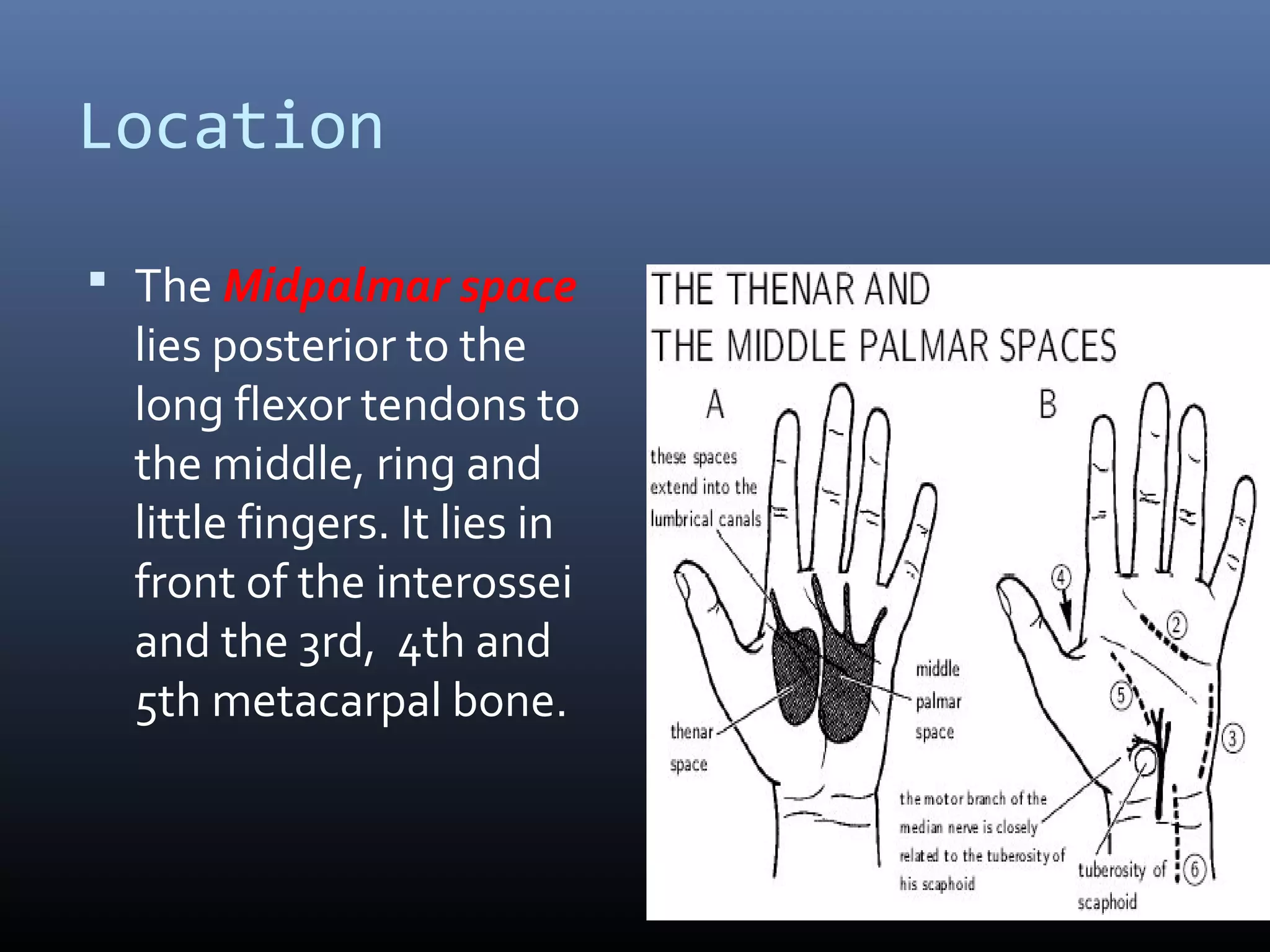 Palmar spaces - Types / contents | PPT