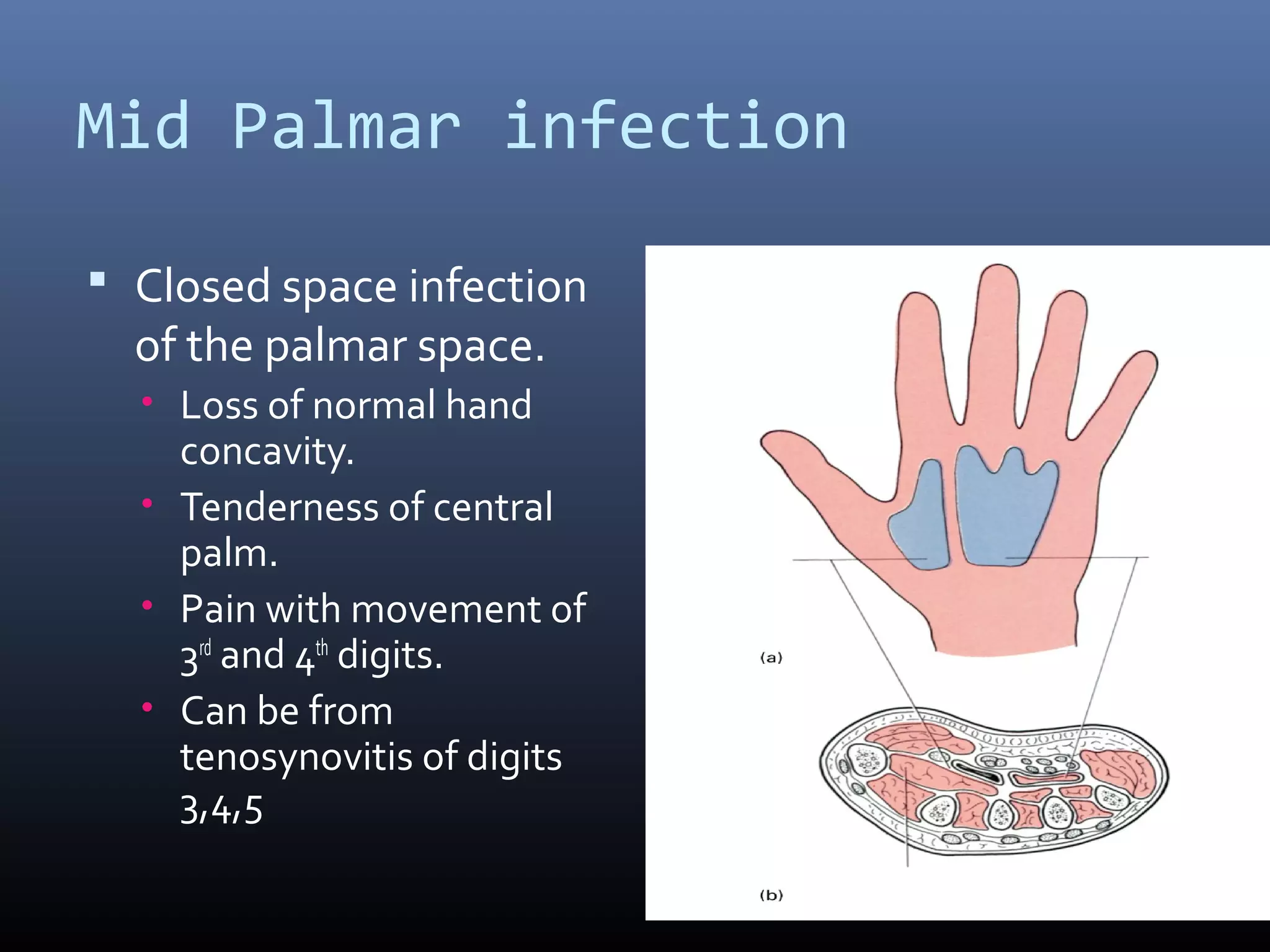 Palmar spaces - Types / contents | PPT