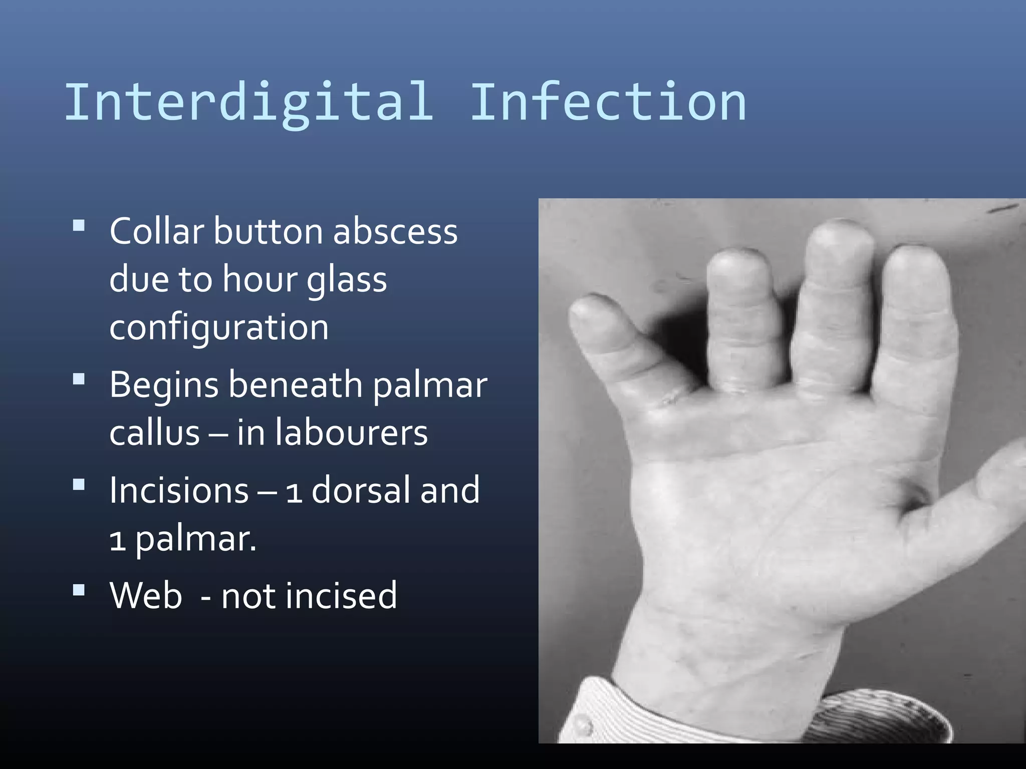 Palmar spaces - Types / contents | PPT