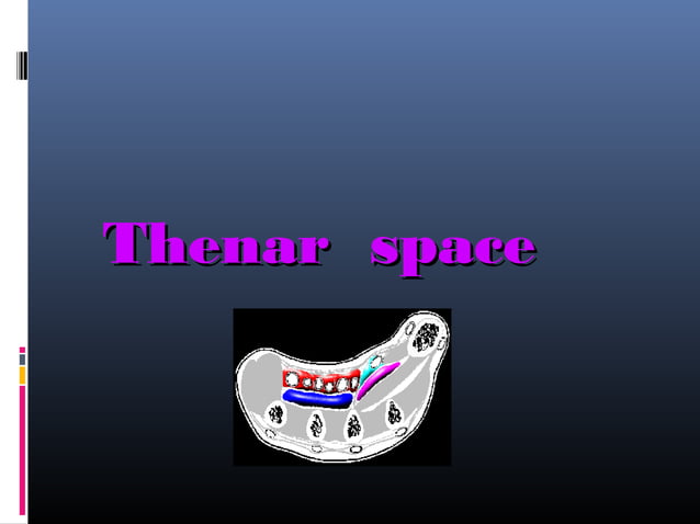 Palmar spaces - Types / contents | PPT