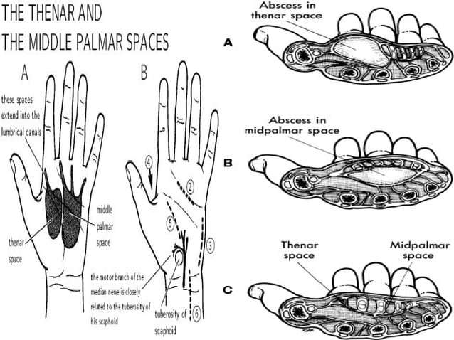 Palmar spaces - Types / contents | PPT
