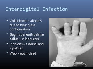 Palmar spaces - Types / contents | PPT