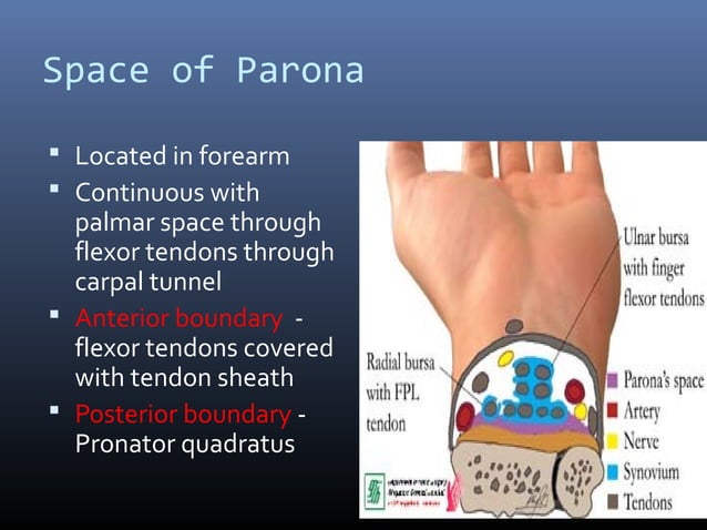 Palmar spaces - Types / contents | PPT