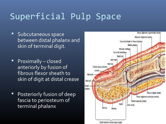 Palmar spaces - Types / contents | PPT
