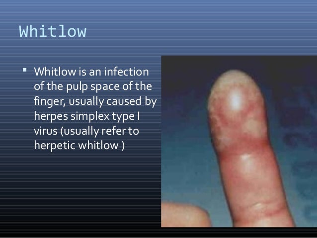 Palmar spaces - Types / contents