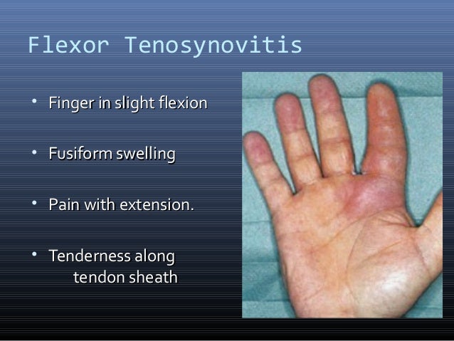 Palmar spaces - Types / contents