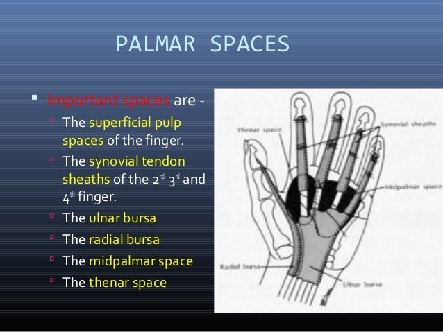 Palmar spaces - Types / contents
