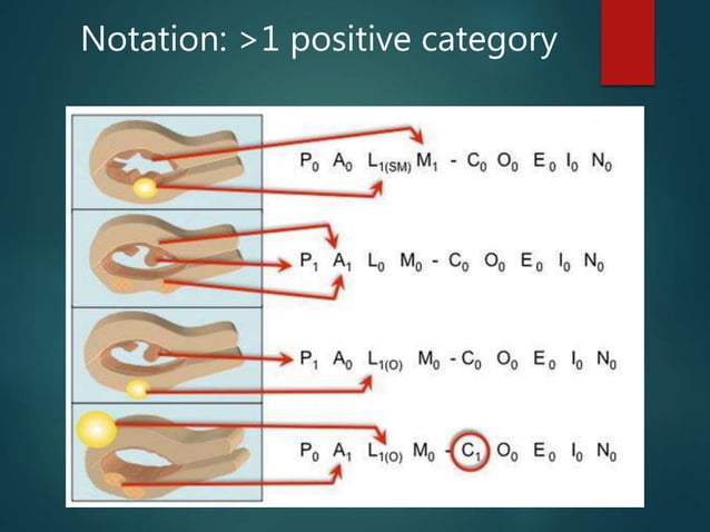 Palm coein clasification