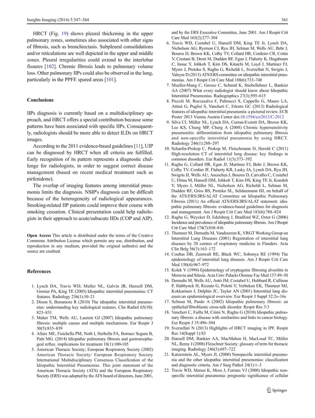 Clinical and radiological features of idiopathic interstitial ... Clinical and radiological features of idiopathic interstitial ...