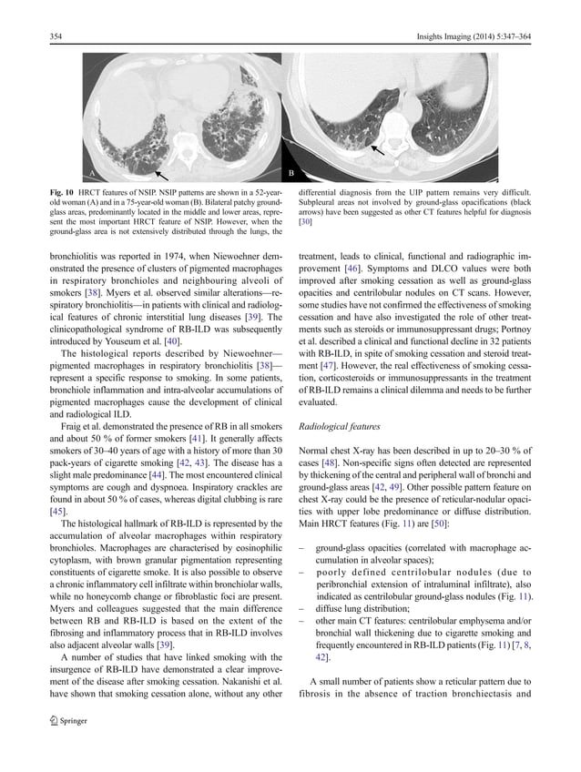 Clinical and radiological features of idiopathic interstitial ... Clinical and radiological features of idiopathic interstitial ...