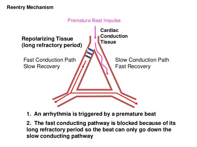 Palpitation, Breathlessness, arrhythmia