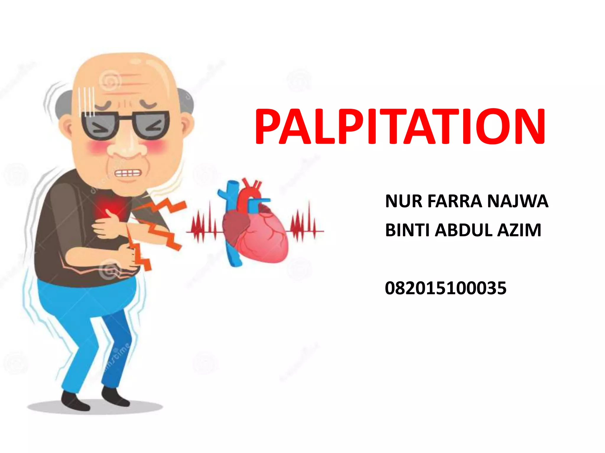 Palpitation | PPTX