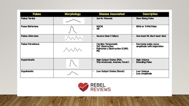 Palpitation - Propedeutics of Internal Diseases.pptx