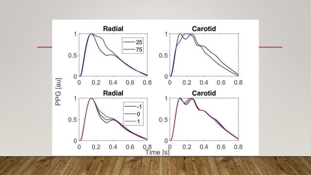 Palpitation Propedeutics Of Internal Diseases pptx palpitation-propedeutics-of-internal-diseases-pptx