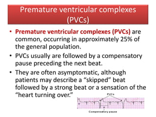 Palpitation in children | PPT