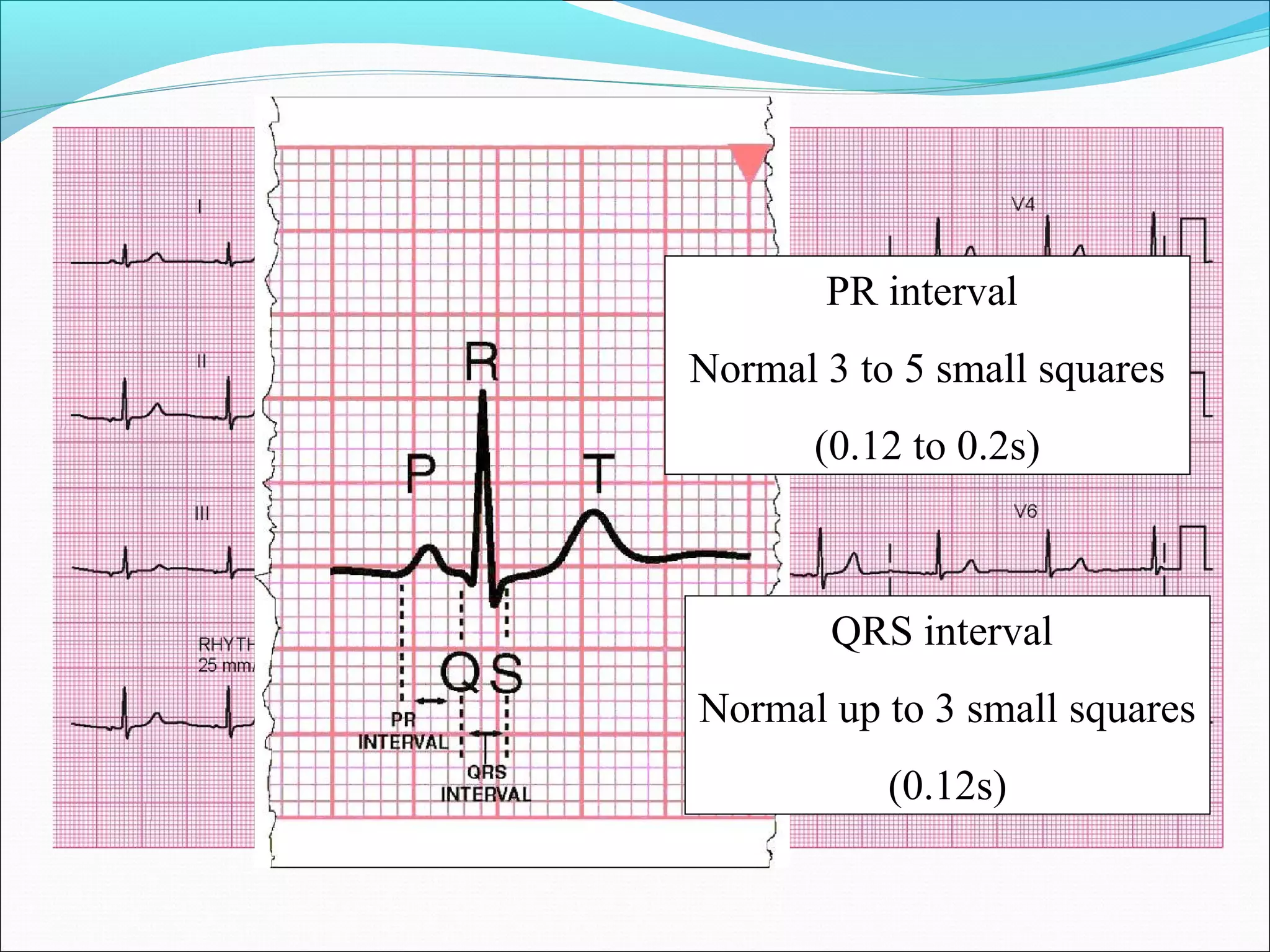 Palpitations | PPT