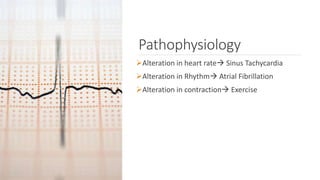 Palpitations.pptx
