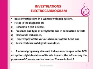Palpitations in pregnancy by dr alka mukherjee dr apurva mukherjee ...