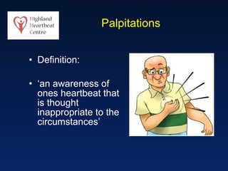 Palpitations Talk | PPT